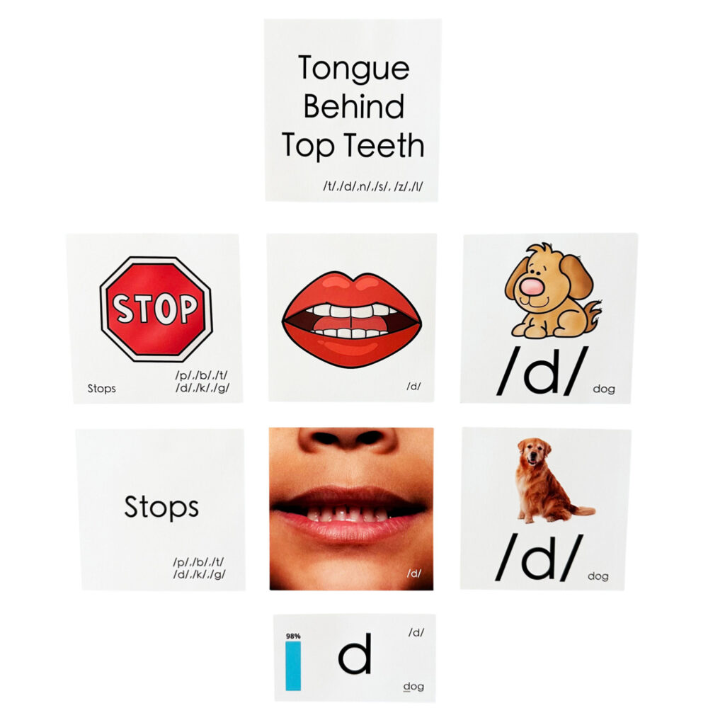 Vowel Sound Wall Cards | Science of Reading Phonics Tool